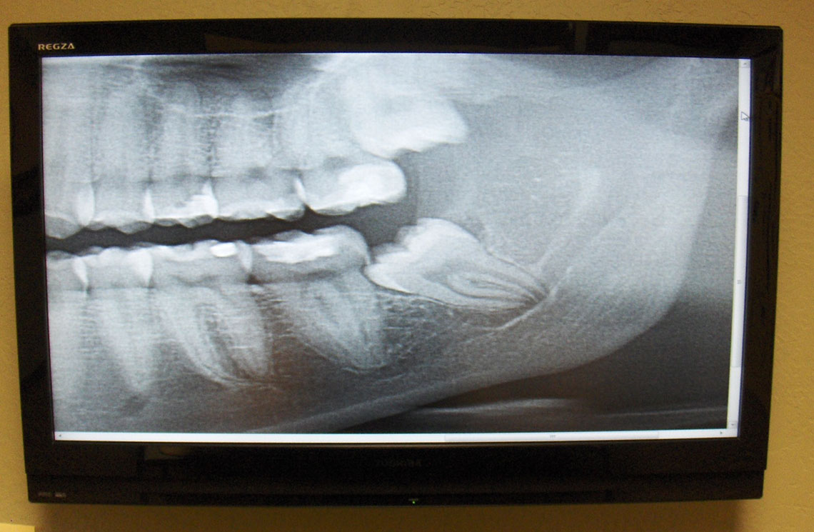 Digital Radiography in Katy TX | Crabtree Dental